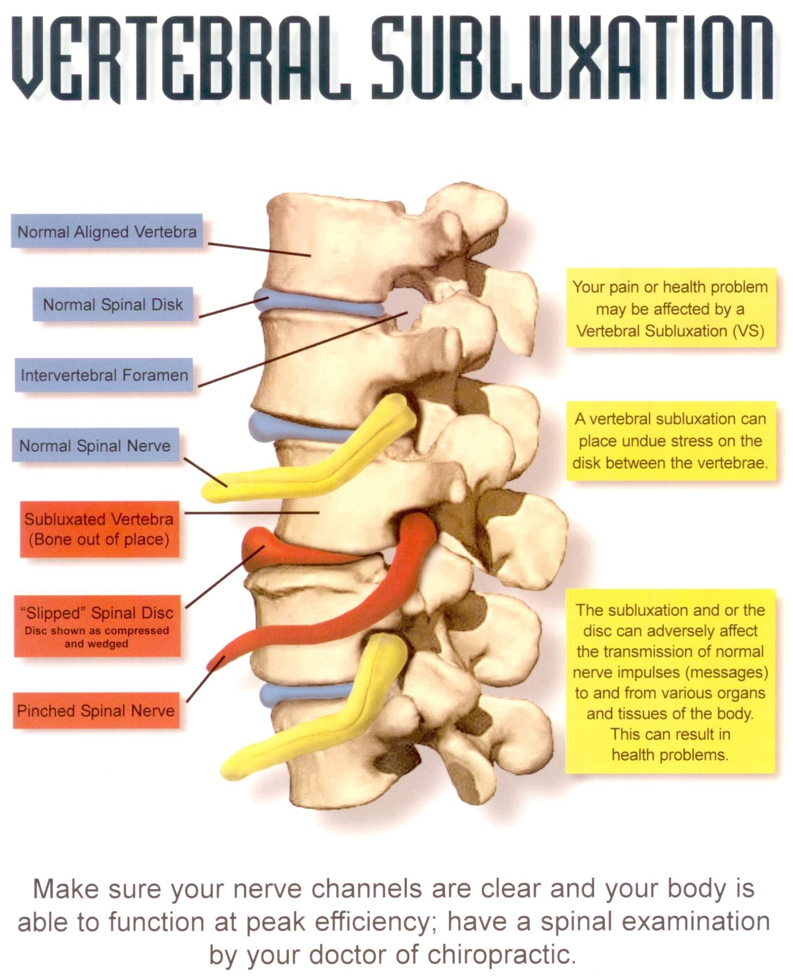 Subluxation | The Daily Omnivore