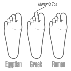 Morton’s Toe | The Daily Omnivore